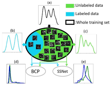 CVPR2023 | Bidirectional Copy-Paste for Semi-Supervised Medical Image Segmentation - 技术分享